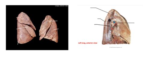 Lung Cadaver Diagram Quizlet