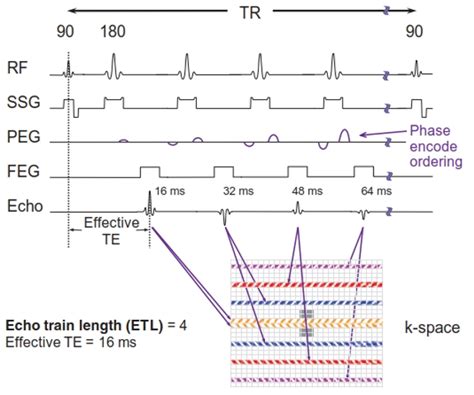 Sekuen Fast Spin Echo Pada Modalitas Mri Readyexpose