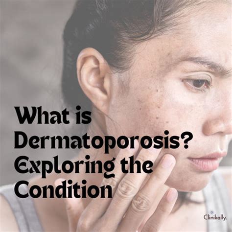 What Is Dermatoporosis Causes Symptoms And Treatment Options