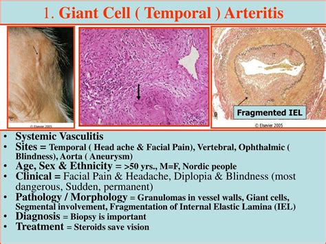 Ppt Blood Vessels Powerpoint Presentation Free Download Id885800
