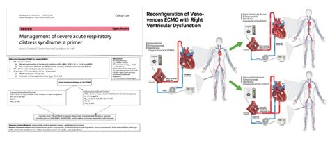 Velia Marta Antonini On Linkedin Ards Ecmo Ecls Foamcc Foamecmo
