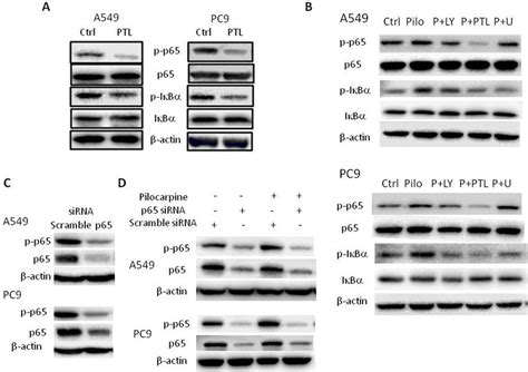 Blocking Nf κb P65 Signaling Abolishes Pilocarpine Induced Nf κb P65
