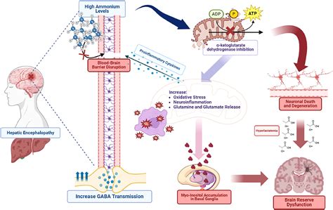 Brain Reserve In Hepatic Encephalopathy Pathways Of Damage And