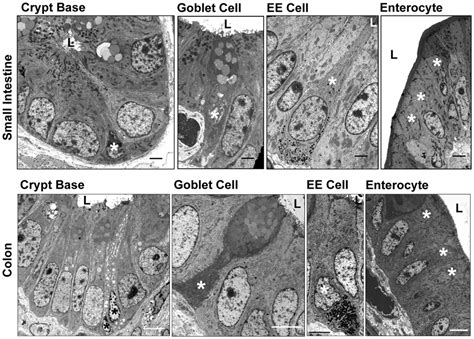 Entero Endocriene Cel Wikipedia