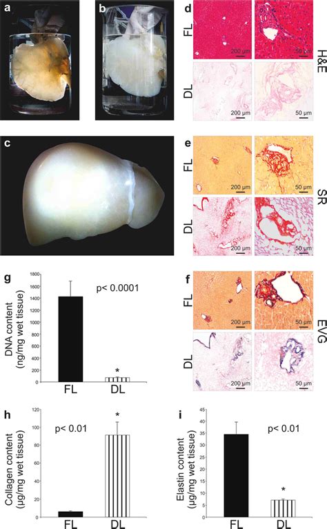 Perfusion Decellularization Of Human Liver Macroscopic Appearance Of A