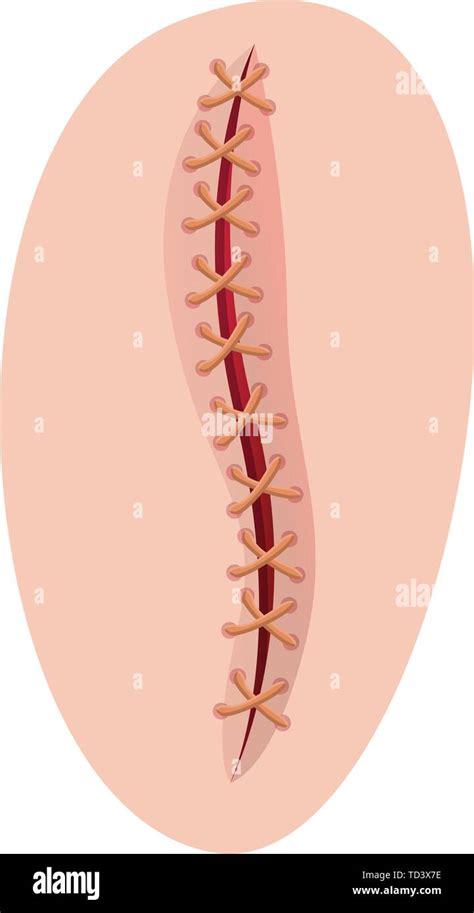 Incision Suture Icon Cartoon Of Incision Suture Vector Icon For Web