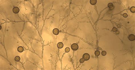 Oomycetes Microscope