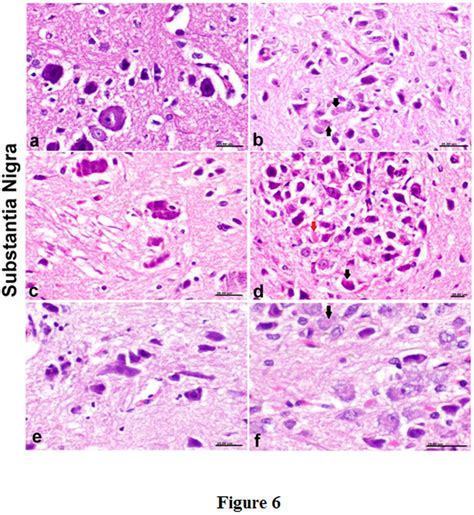 Histological Sections Of Substantia Nigra In Different Groups A