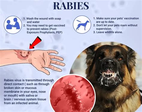 Rabies Nurses Revision