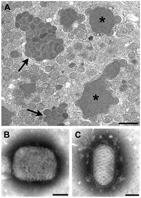 Electron Microscope Images Virus