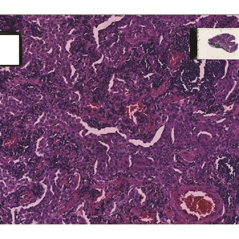 Low Power Overview Showing Dip And Rb Ild With Adjacent Normal But