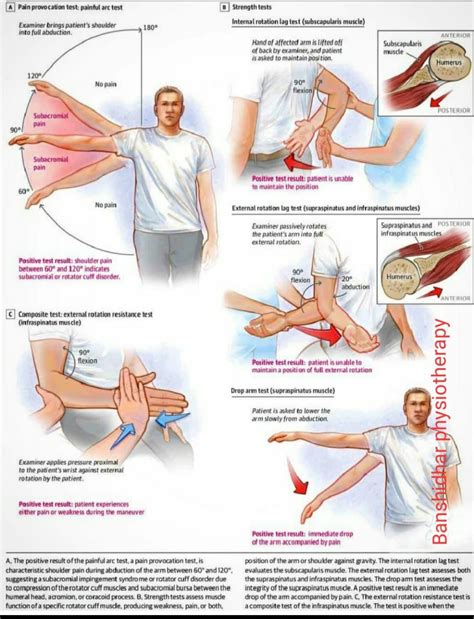 Drop Arm Test For Diagnosing Supraspinatus Tendon Tear 48 Off
