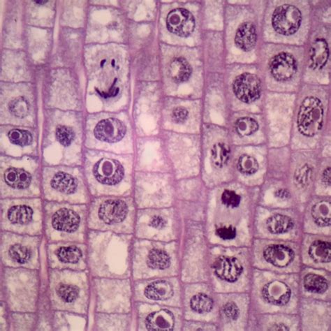 Metaphase Of Mitosis Under Microscope How To Identify Stages Of Mitosis Within A Cell Under A