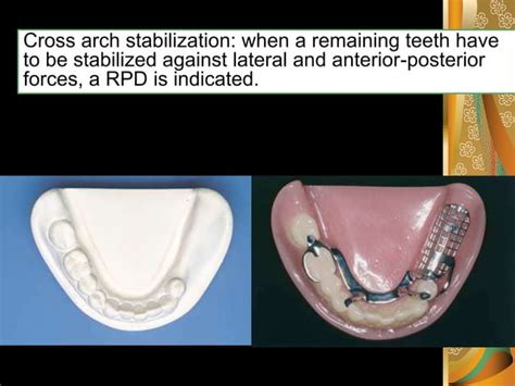 Kennedy Classification Pptx