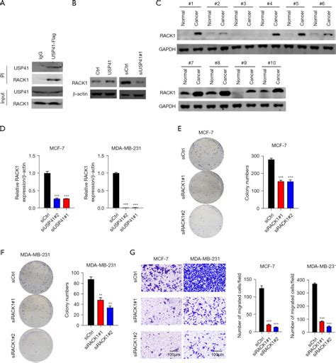 Usp41 Promotes Breast Cancer Via Regulating Rack1 Pmc