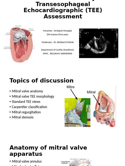 Evaluation Of Mitral Valve Tee Approach Pdf Heart Valve