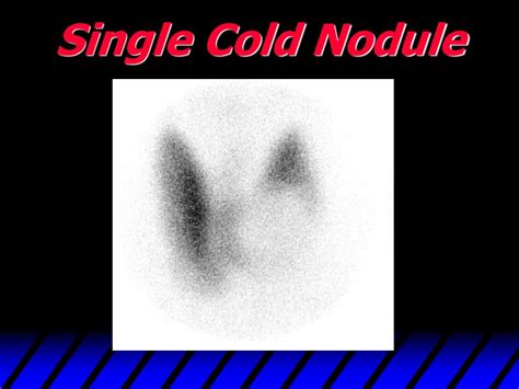 Ppt Thyroid Scan Powerpoint Presentation Free Download Id 437897