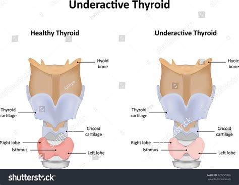 4 Under Active Thyroid Gland 图片、库存照片和矢量图 Shutterstock