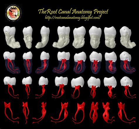 Root Canal Anatomy Which Root Canal Treatment Is Easier Incisor Or