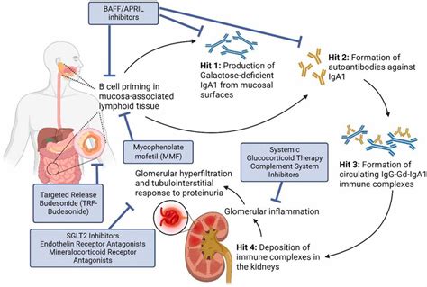 Proposed Four Hit Hypothesis Of Igan Pathogenesis And Current Download Scientific Diagram