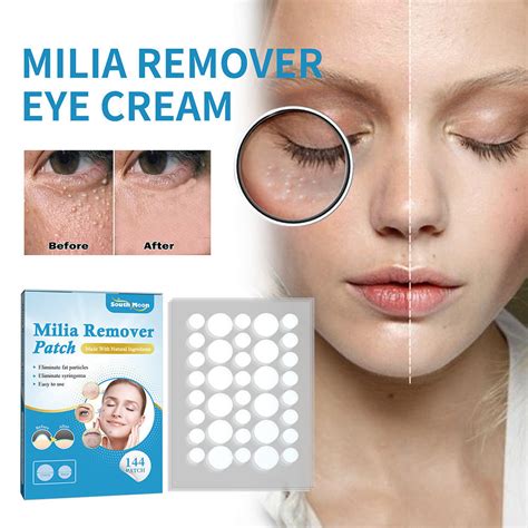 144pcs Milia Spot Patch Helps Dissolve Reduce Milia Zit And Pimple