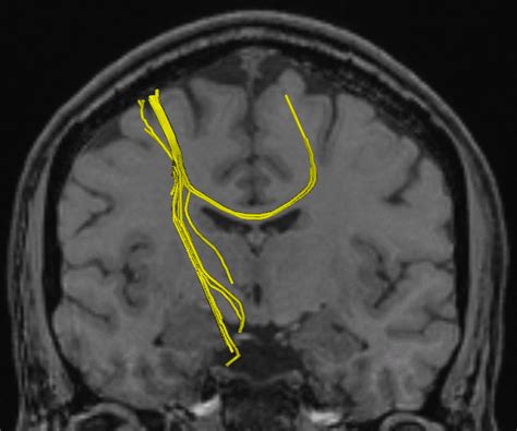 Shape Analysis Group Projects