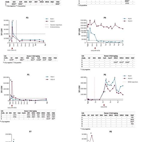 Evolution Of Anti Hla Antibodies Levels Sfi And Dsa Mfi In The Eight Download Scientific