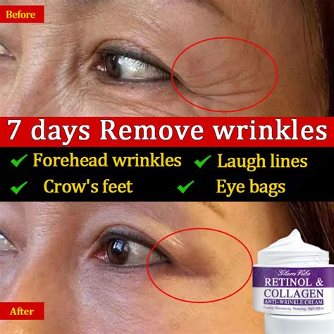 【quickly Eliminate Wrinkles】 Anti Aging Lifting And Firming Cream