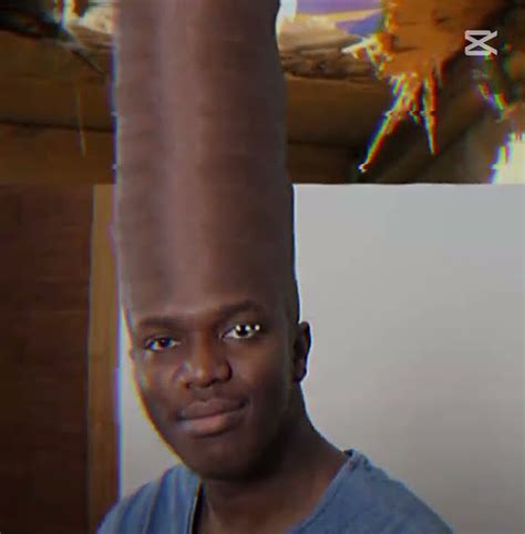 Who Has The Biggest Forehead Youtube