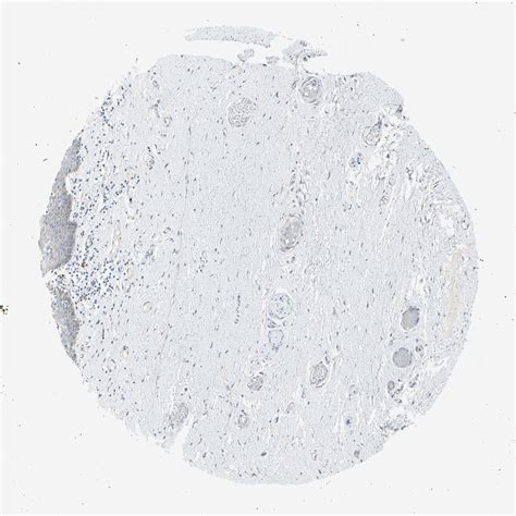 Tissue Expression Of Tmigd2 Staining In Skin The Human Protein Atlas