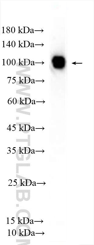 Results For Ythdc1 Proteintech Group