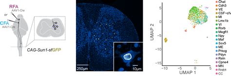 Regional And Cell Type Specific Connectivity Of Corticospinal Circuits Burke Neurological