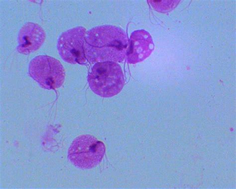 Trichomoniasis Pictures Under Microscope