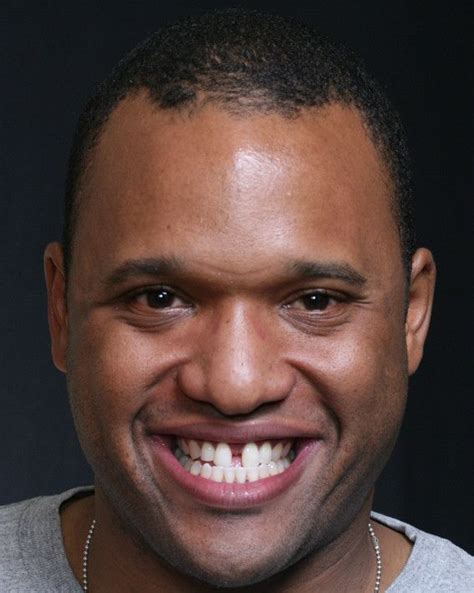 Eliminating Gaps Gallery Teeth Transformations Amy Norman Dds