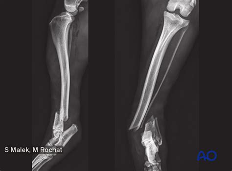 Release Notes Dog Distal Tibia And Malleoli