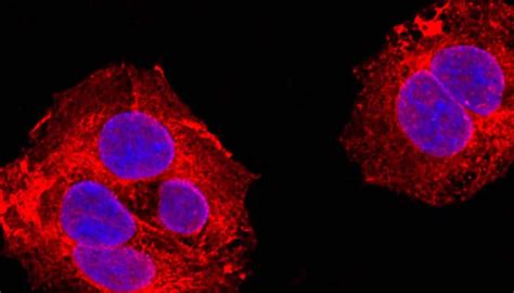 Better Understanding Of Enzyme Mutation Process Provides Hope For New Pathways To Treatment Nfcr