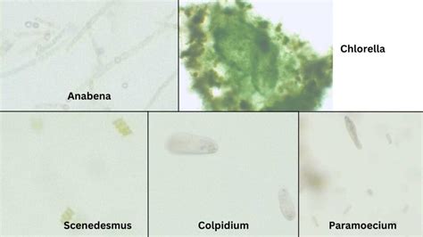 Pond Water Under The Microscope Biology Notes Online