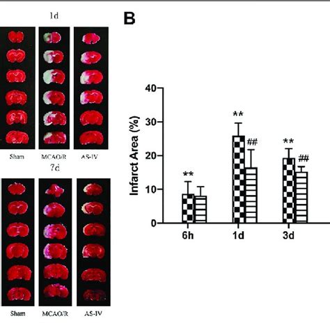Interobserver Agreement Using The Tici Reperfusion Scale Download Table