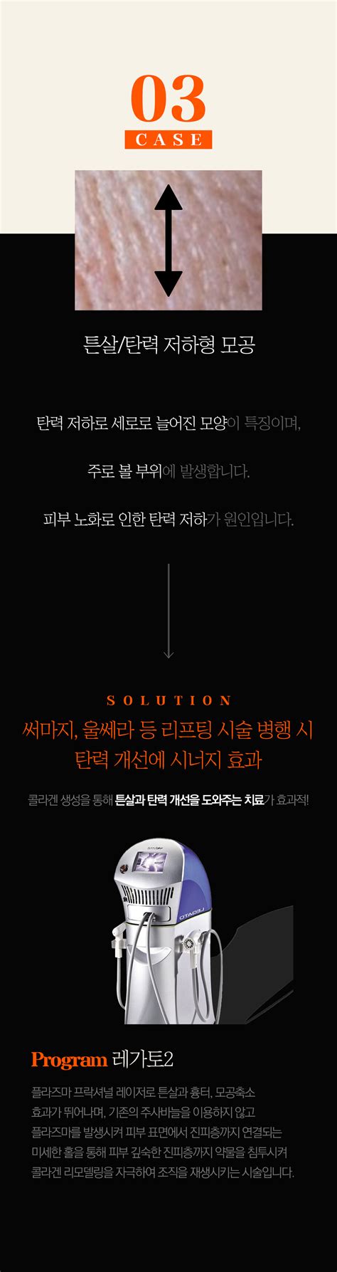 모공쫀쫀도자기피부만들기 By 에르네의원 강남언니 1등 성형수술and피부시술 정보앱