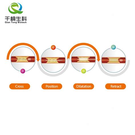 China Pulmonary Angiogram Catheter Manufacturers Suppliers Factory Wholesale Service