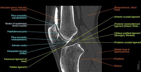 Anatomy Of The Knee Ct Arthrography E Anatomy