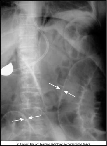 Clin Skills Abdominal Imaging Flashcards Quizlet