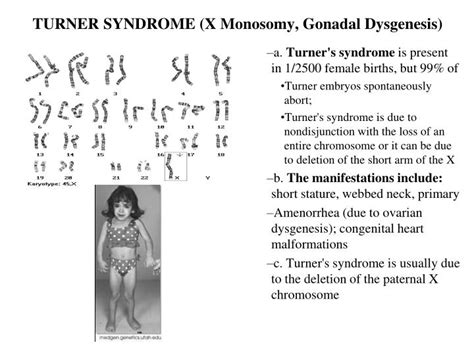 Ppt Congenital Malformations And Teratology Powerpoint Presentation