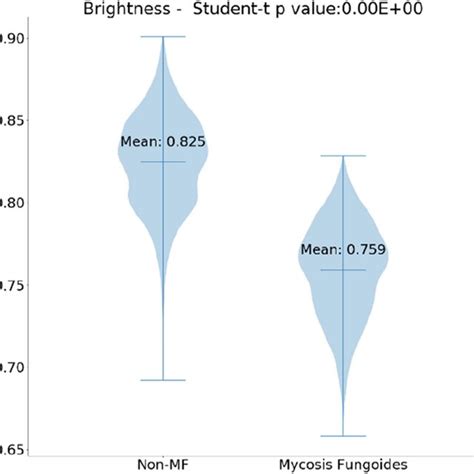 Comparison Of Nuclear Area Between Mf And Non Mf Lymphocytes Download