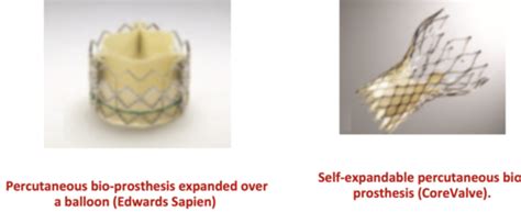 Echo Ii Sess 3 Ppt Prosthetic Valves Flashcards Quizlet