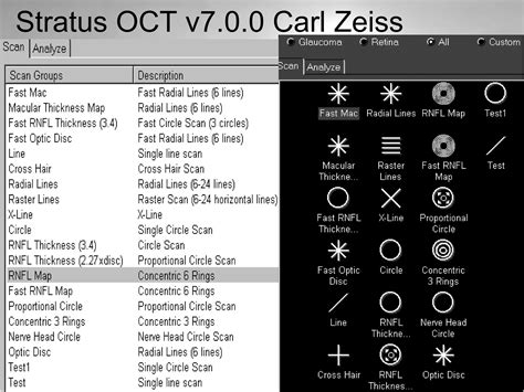 Oct For Glaucoma Hrtclub2013 Ppt