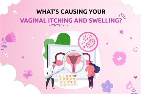 Itchy Vulva