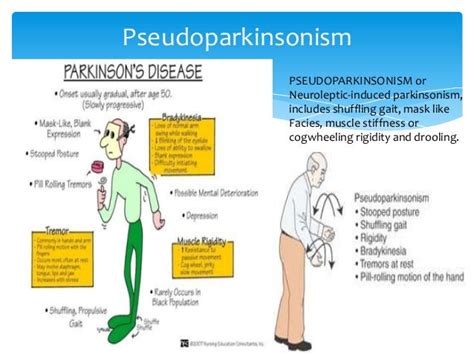 Schizophrenia Medical Management