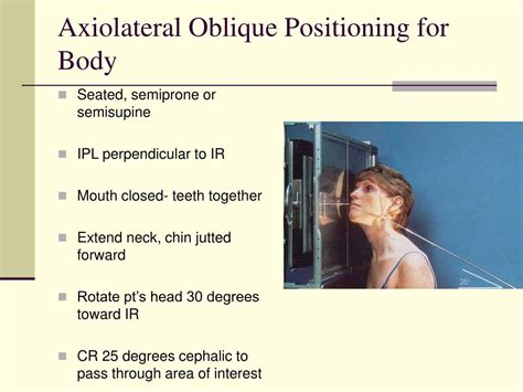 Mandible X Ray Positioning Townes At Daria Willis Blog