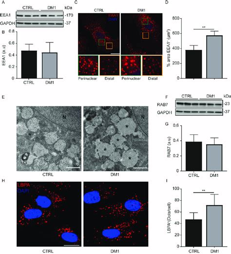 Endosomes Are Enlarged In Dm1 Cells A B Protein Levels Of Early Download Scientific Diagram